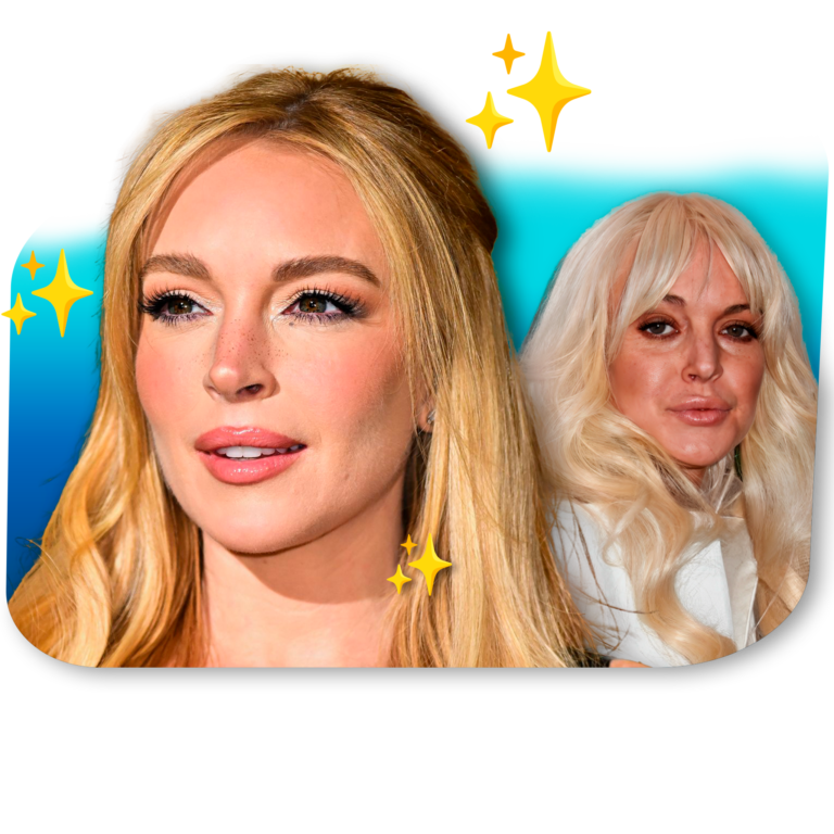 Mini Lifting: Preço, Antes E Depois, Médicos E Muito Mais